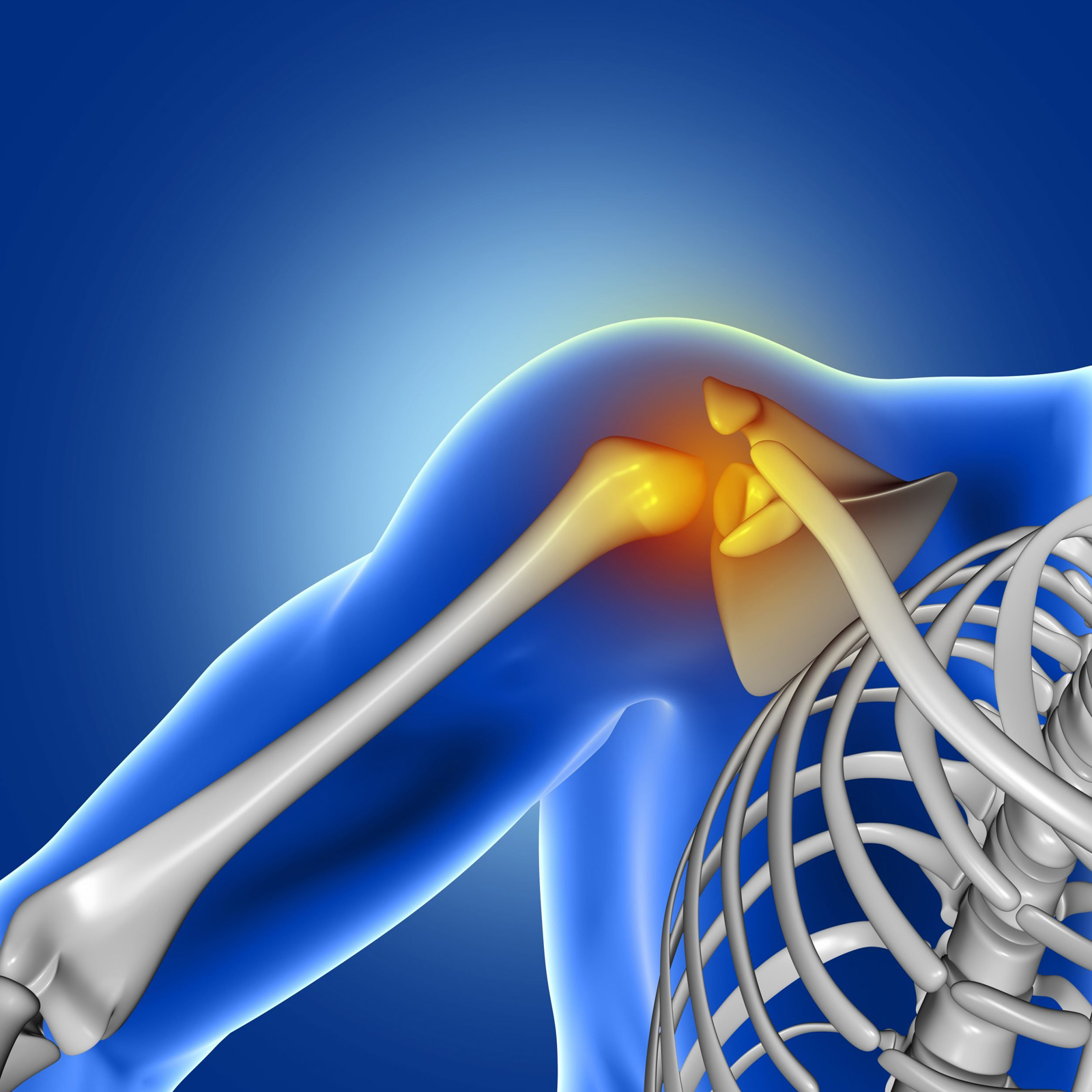 Cas cliniques d'imagerie - Articulation sterno-claviculaire ...